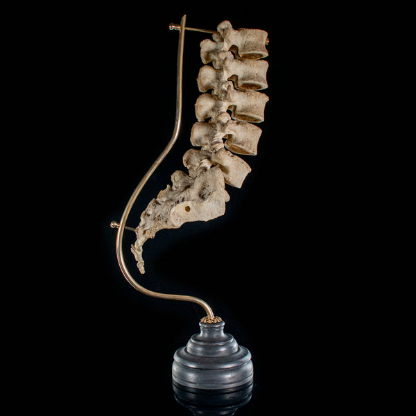 Real Human spine preparation. – Mattaeus Ball