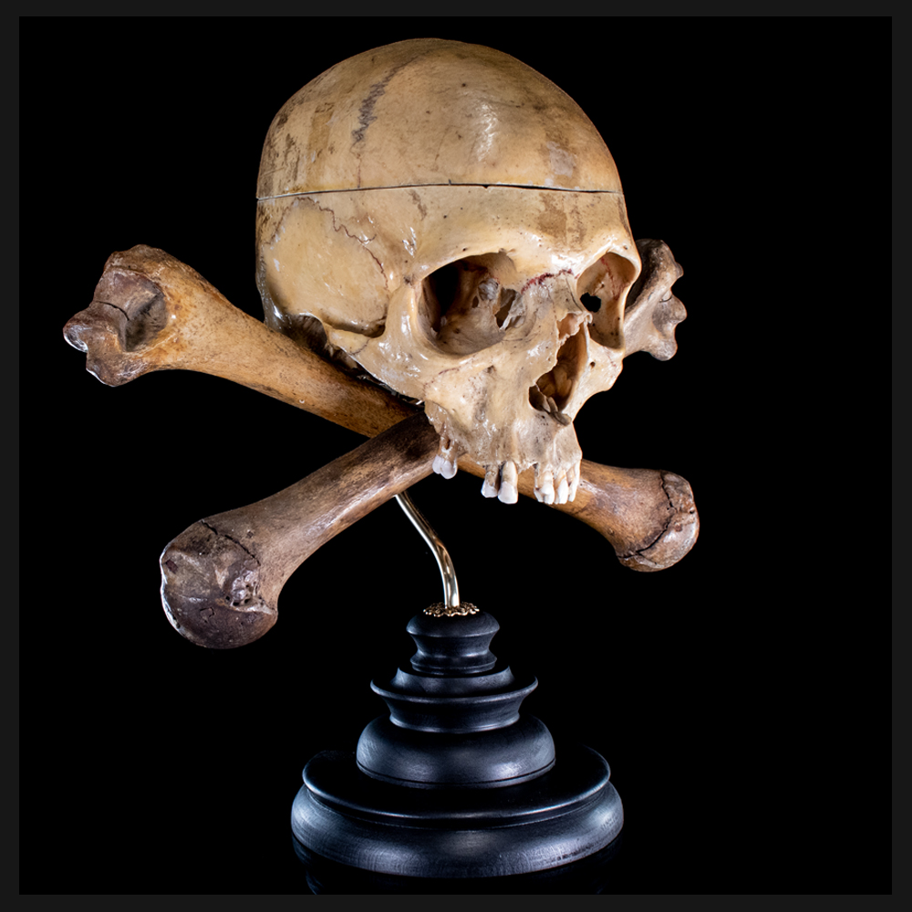 Real human skulls for sale, By Mattaeus Ball