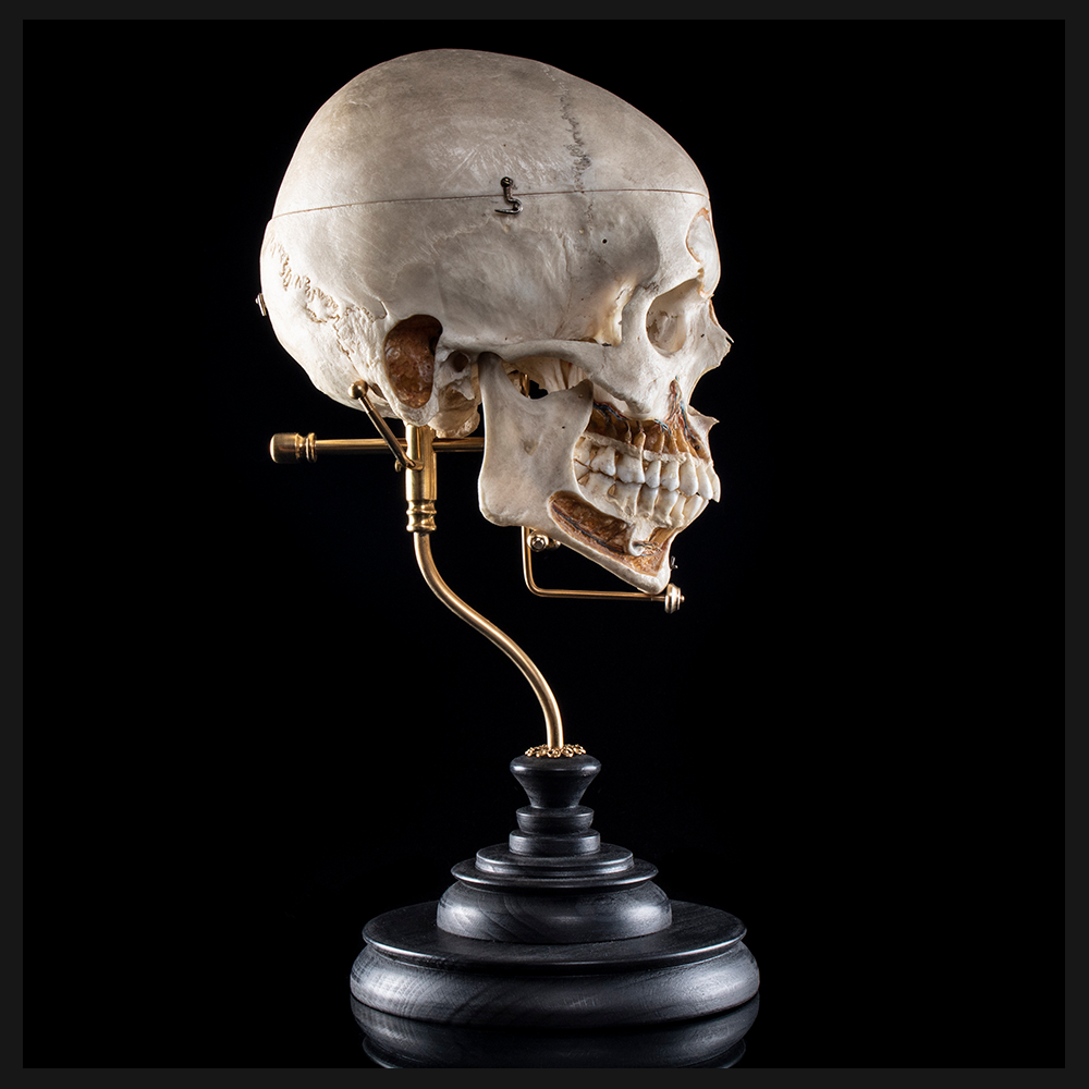 Real human skulls for sale, By Mattaeus Ball