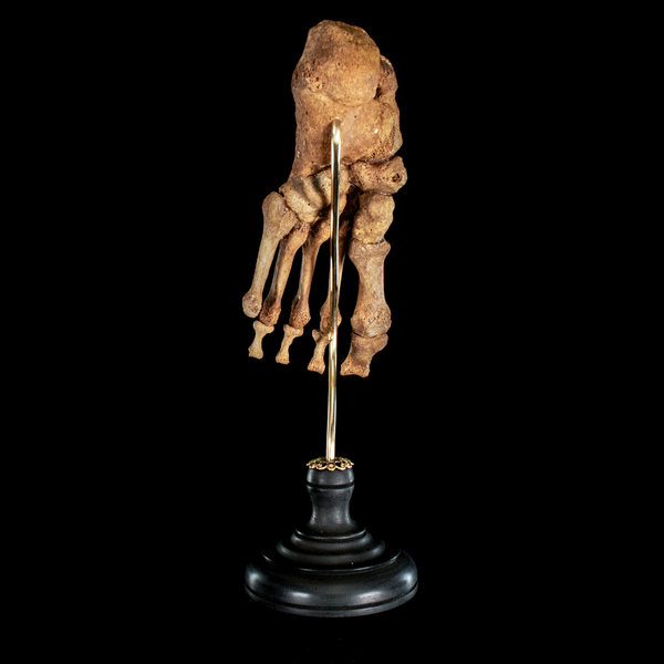Real Human foot for sale, a fantastic piece of medical history ...