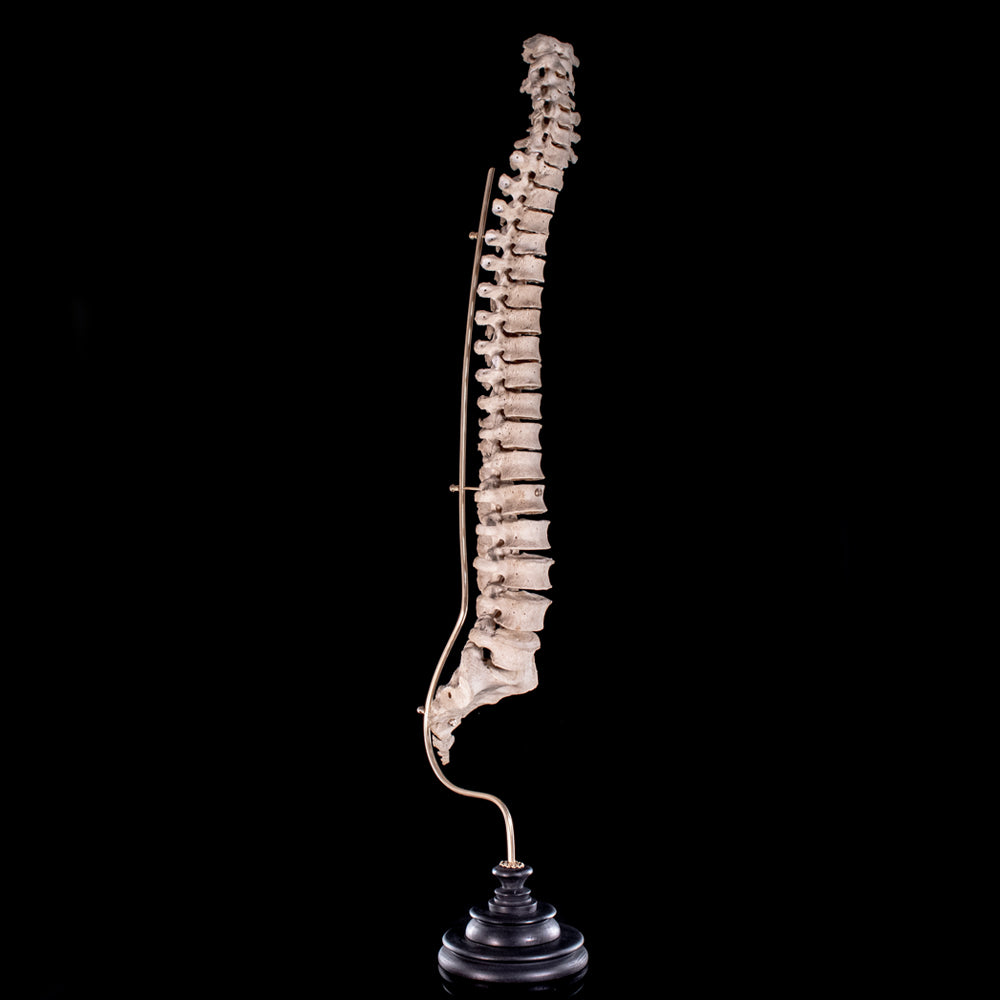 Real human Bones for sale, including real skull and crossbones ...